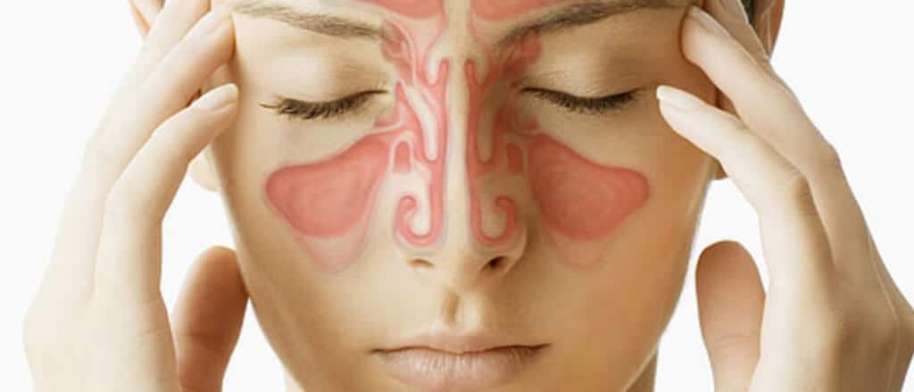 Ennisholubólga og kinnholubólga | Heilsa.is